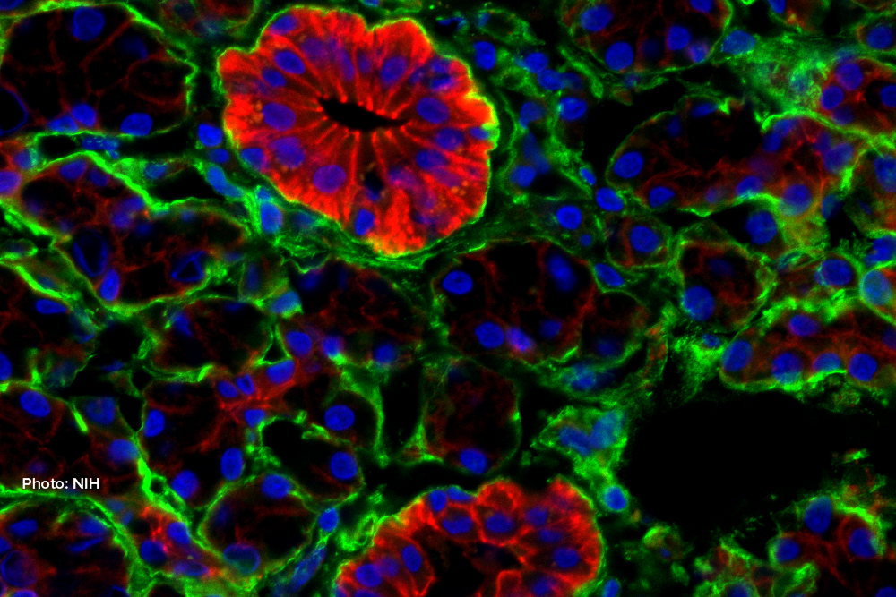 Upcoming Programs — International Society for Stem Cell Research