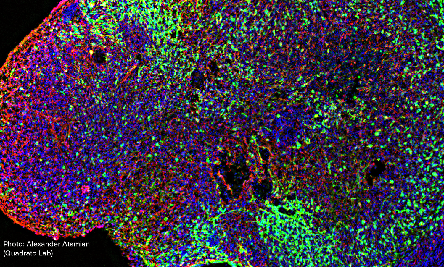 Next Generation Organoids — International Society for Stem Cell Research