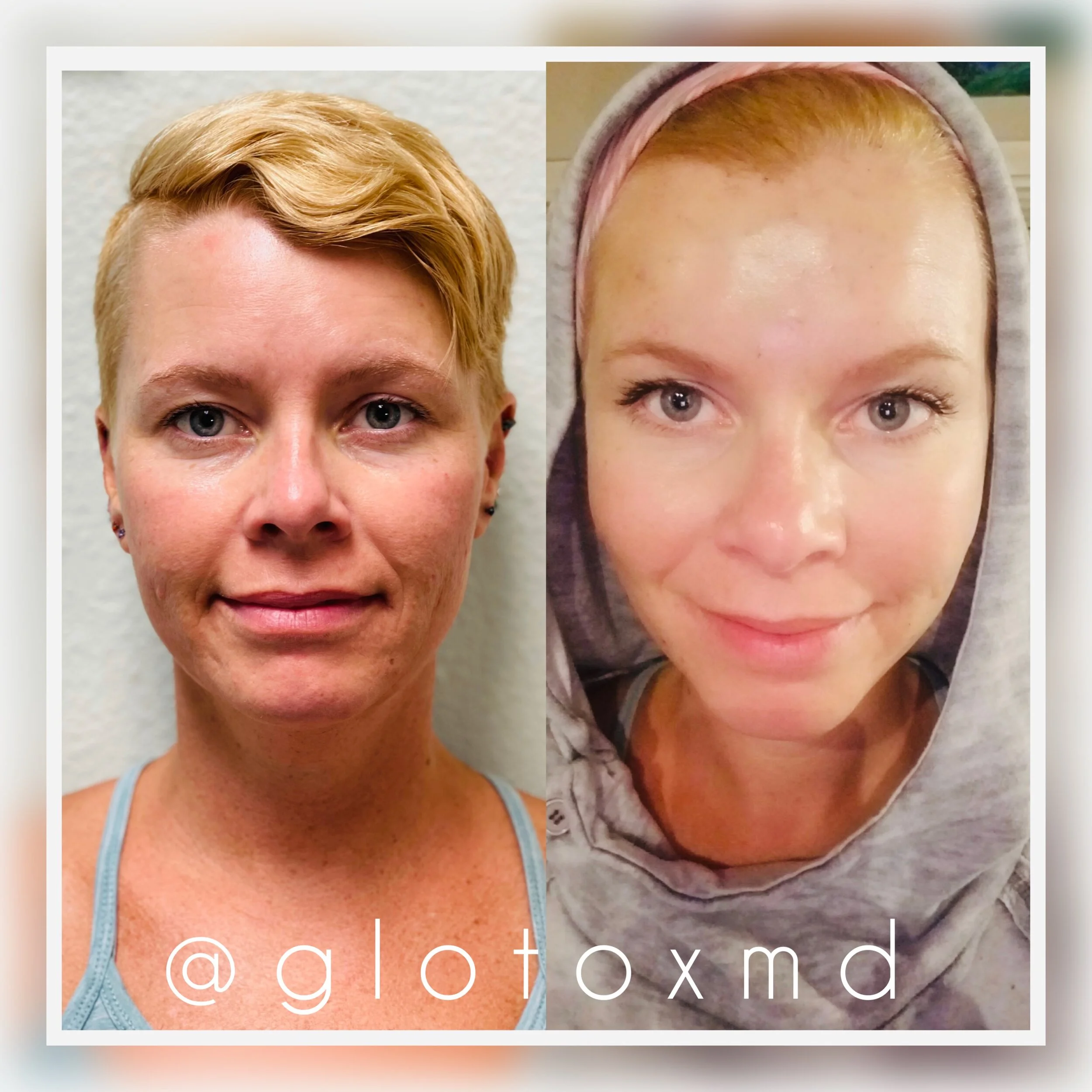 About — Glotox MD - Level up your glow!