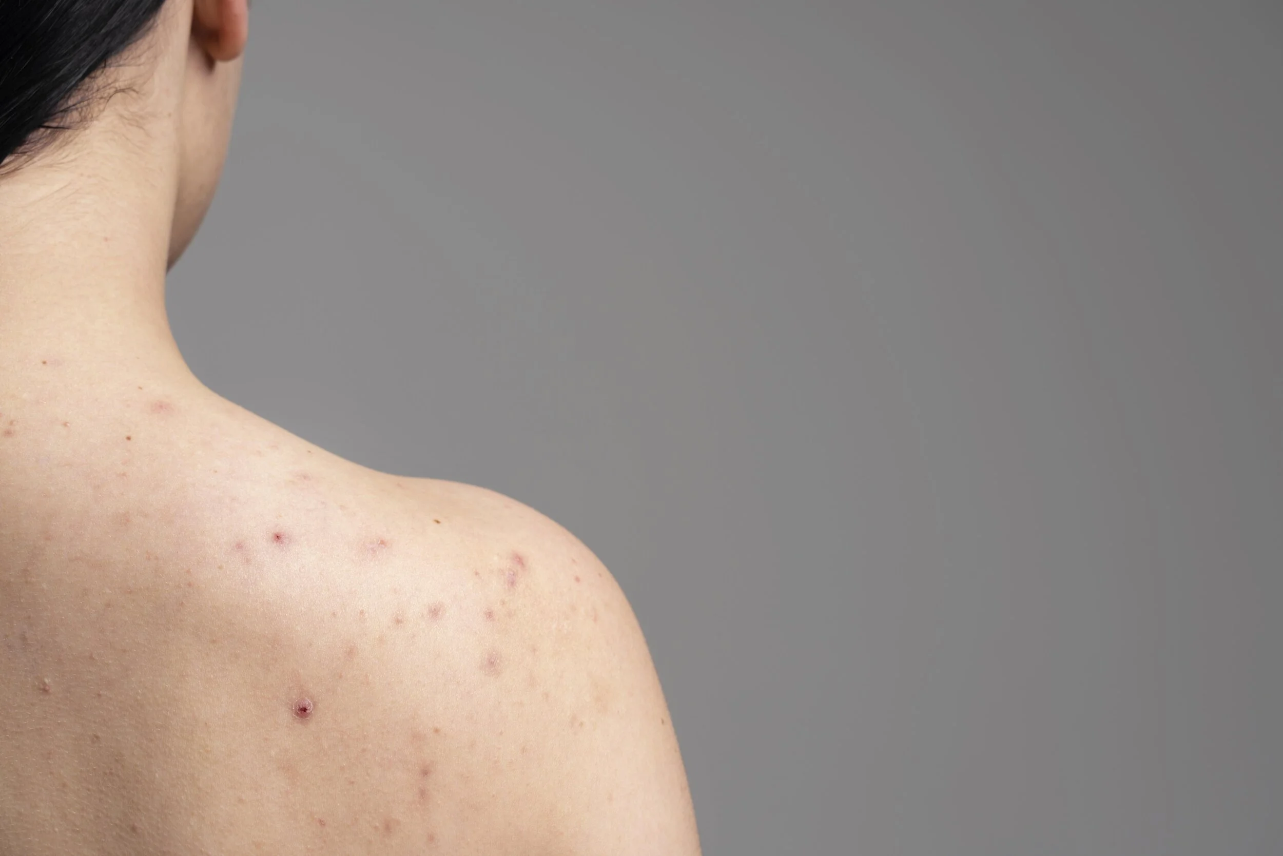 Premier Dermatology of Florida | Dr. Joanna McGetrick