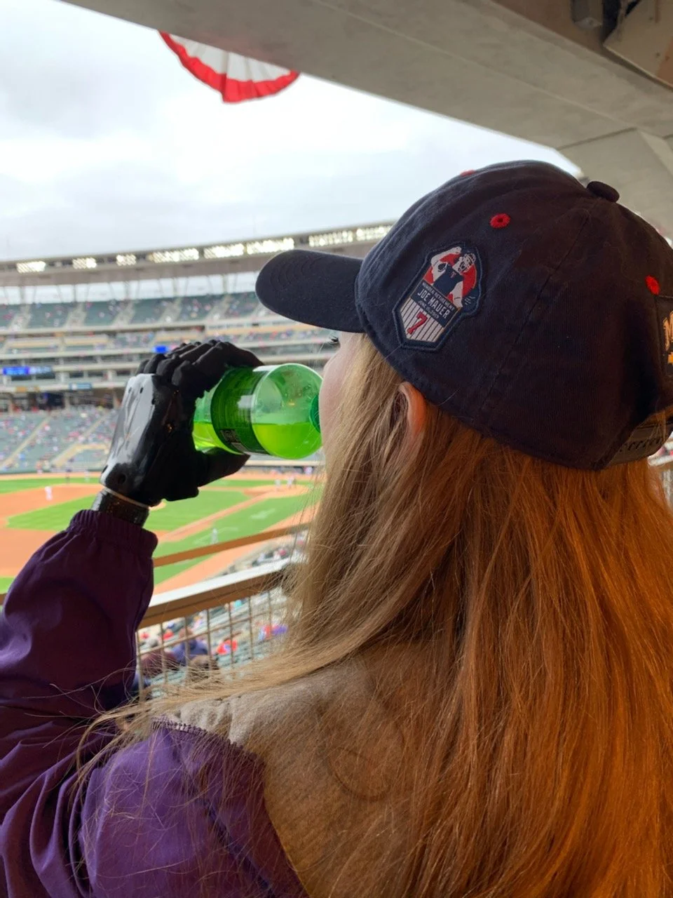 Ability Hand™ — PSYONIC