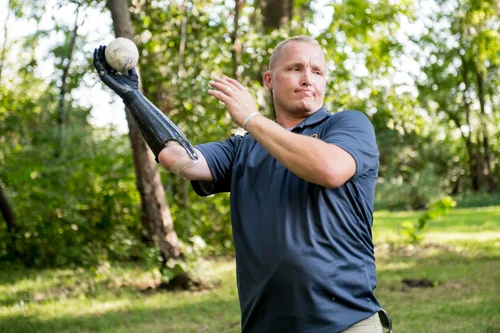 Ability Hand™ — PSYONIC