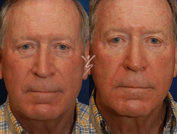 Gallery | View Transformations - Book Your Consultation — About Faces ...