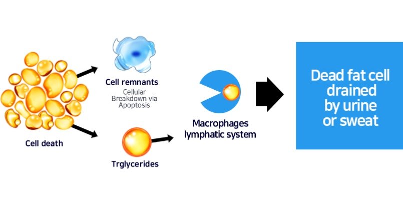Fat Freezing — Gold Coast Dermatology Clinic