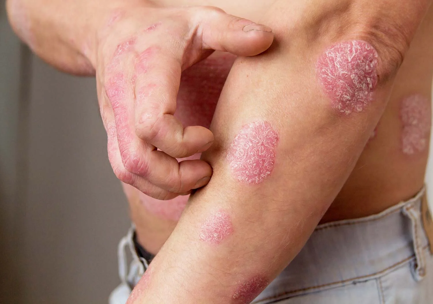 Skin Conditions + Treatments — Gold Coast Dermatology Clinic
