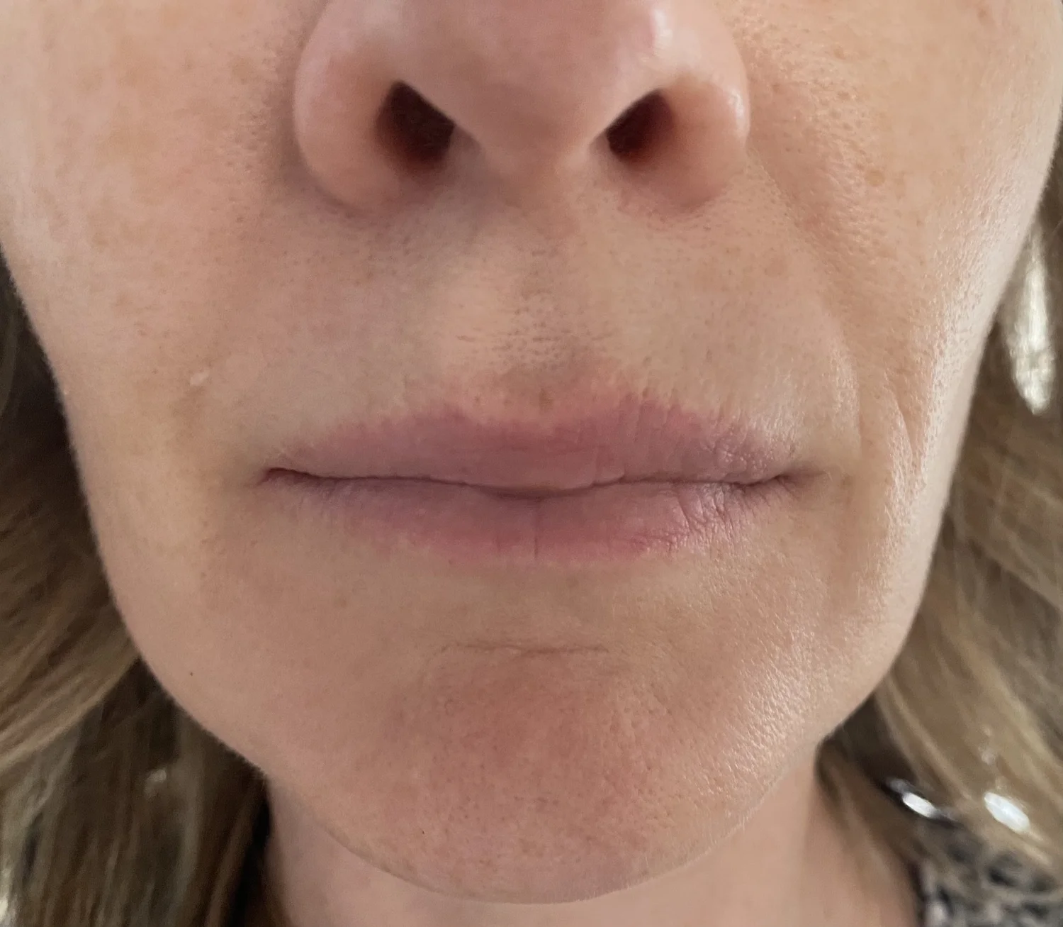 the plague of POD — Gold Coast Dermatology Clinic