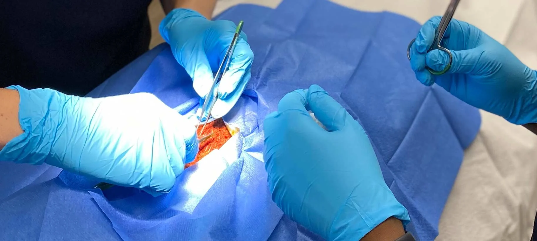 Excision — Fora Dermatology - General & Surgical Dermatology in ...