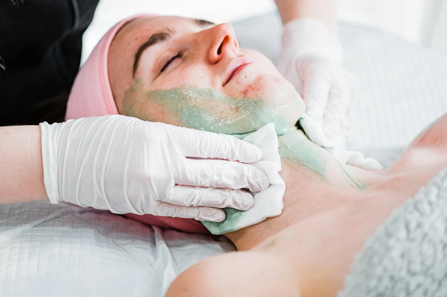 Treatments — Vanity Skin Clinic | Ottawa Acne Treatments
