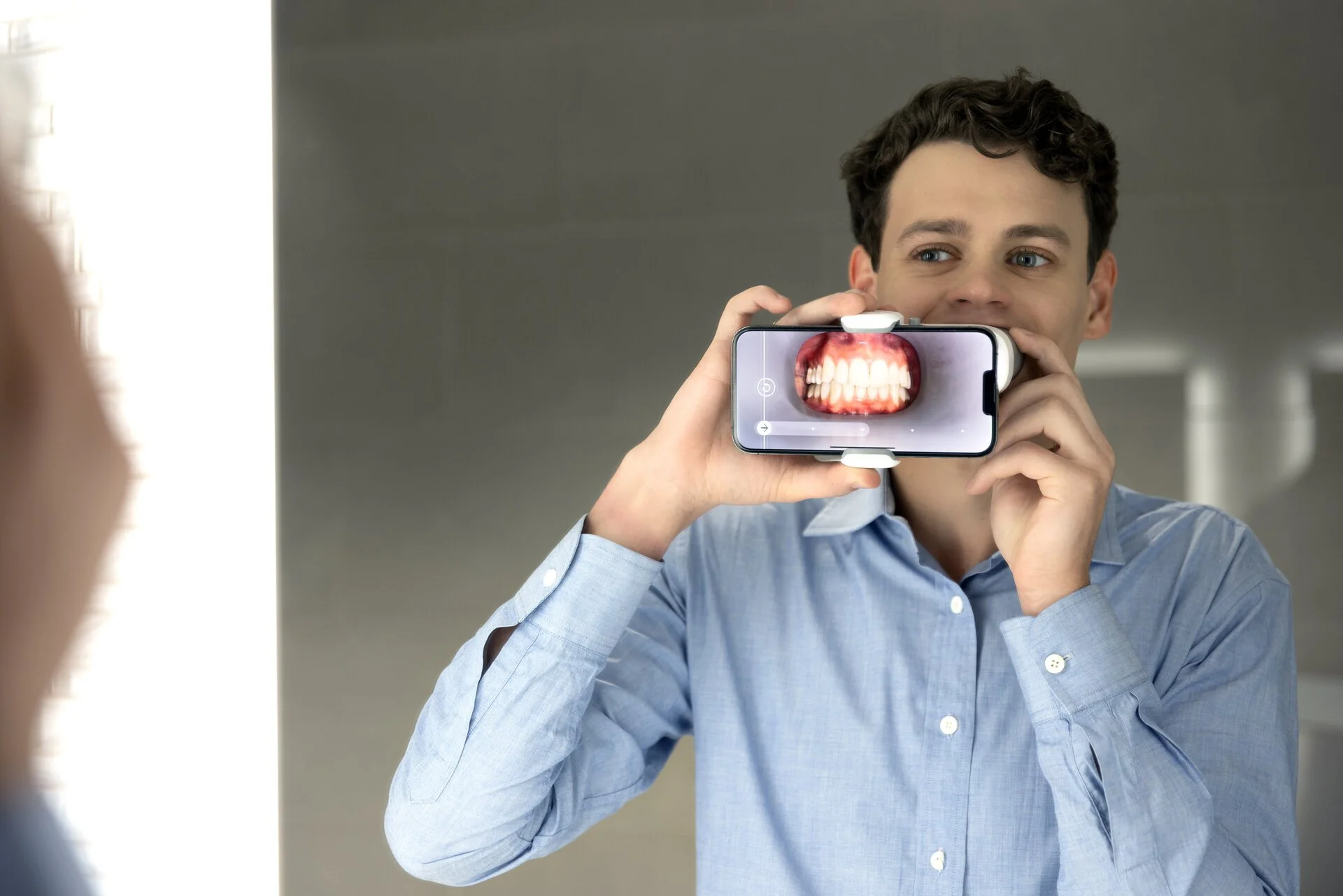 Candid Clear Aligners - Myers Family Dental