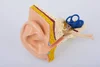 Excess Ear Wax Build Up: Causes, Signs & Treatment | Ear View