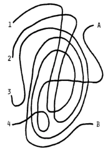 Line Tracing — Reinventing Optometry: OPSIS Optometric Professional ...