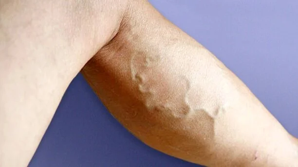 Sydney Vein Specialist Centre