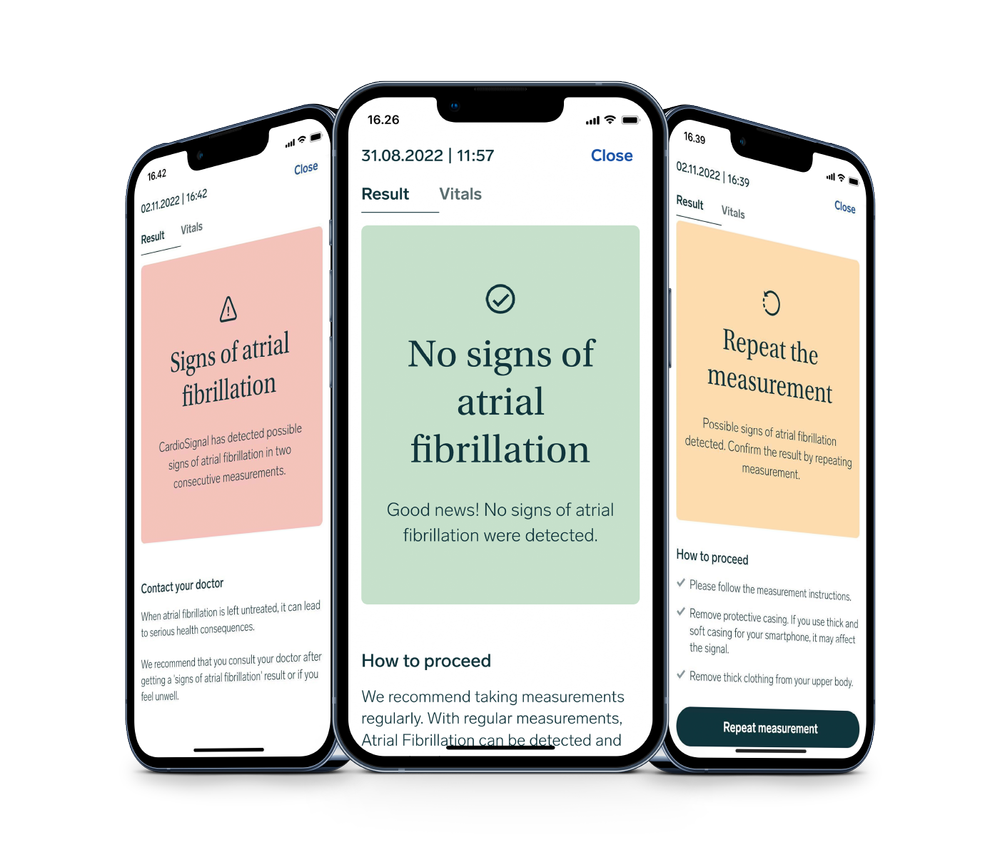 How it works — CardioSignal
