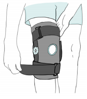 Osteochondral Defect (OCD) Drilling: Post-Operative Instructions