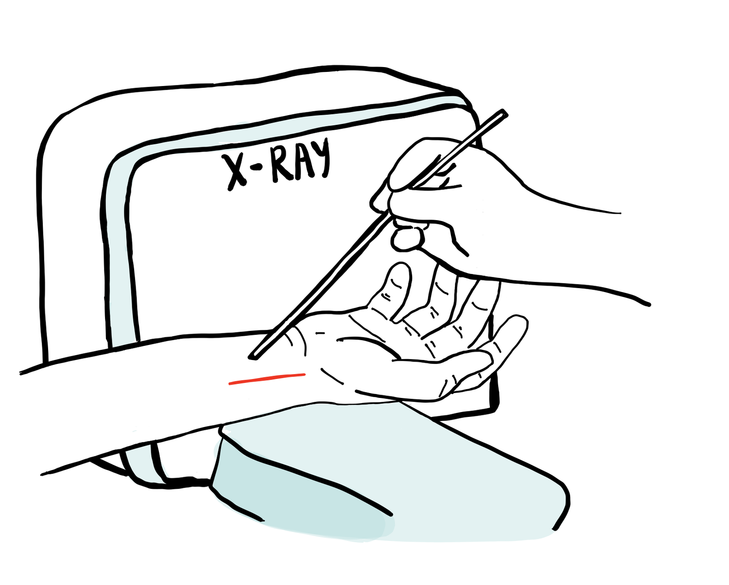 Removal of Wrist Plate