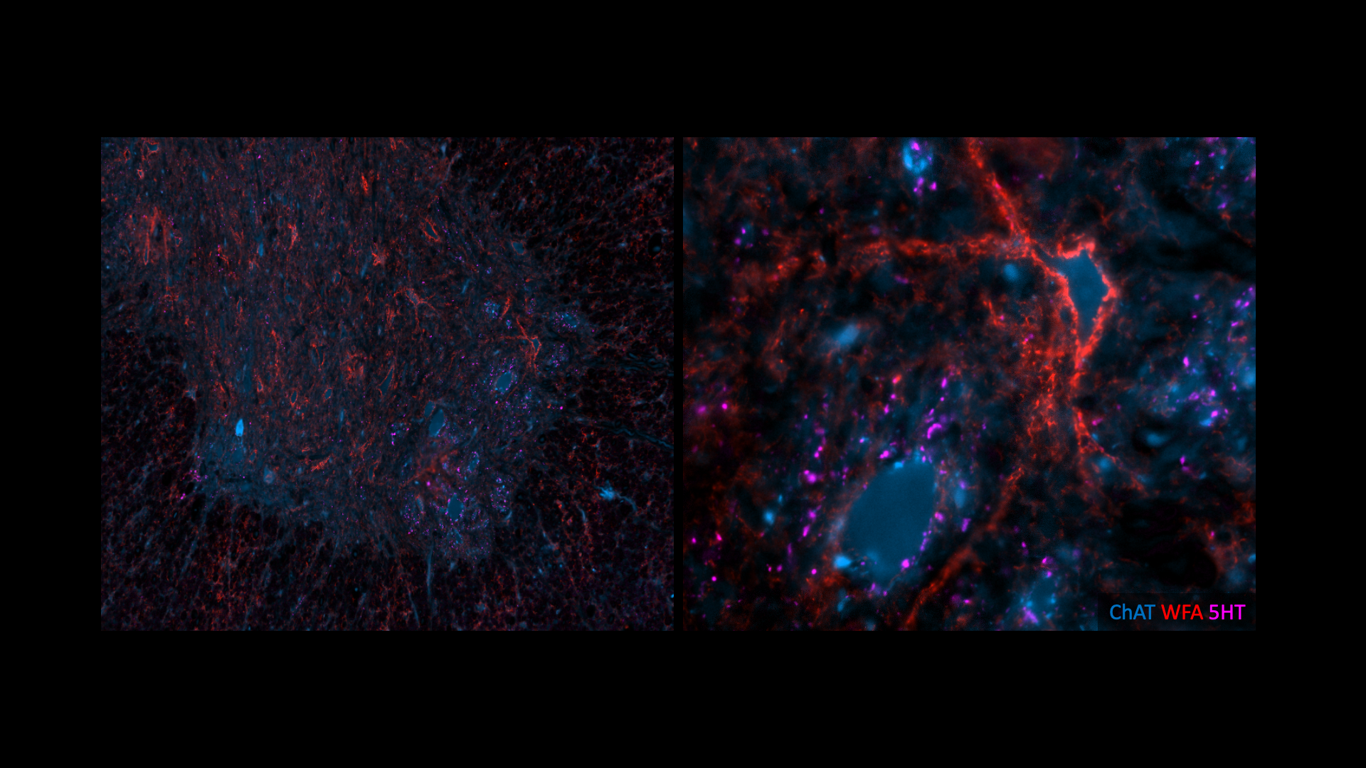 Research — Kwon Lab
