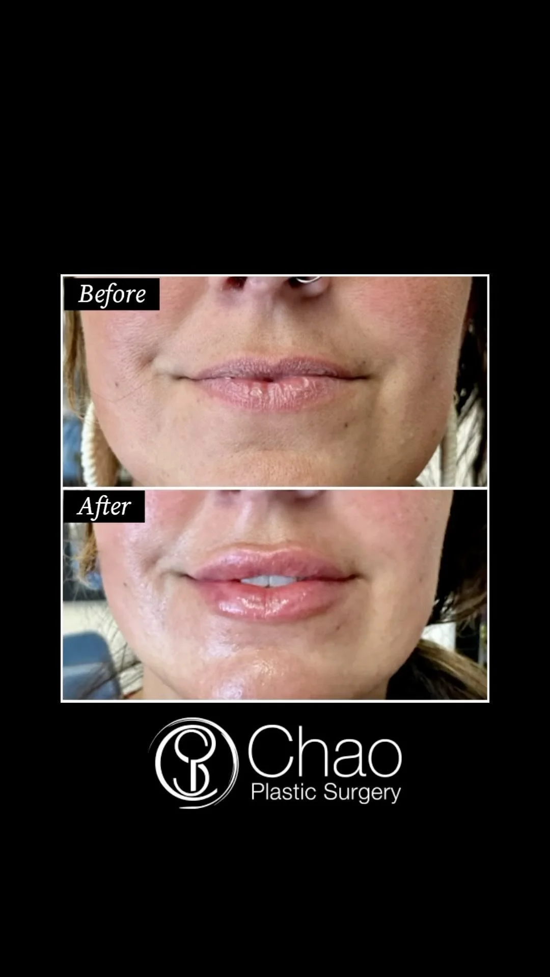 PROCEDURES — Chao Plastic Surgery