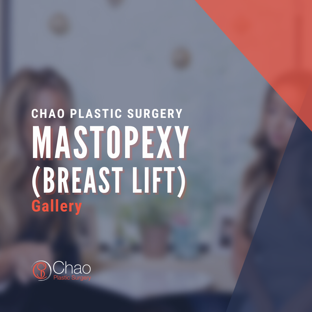 Mastopexy — Chao Plastic Surgery