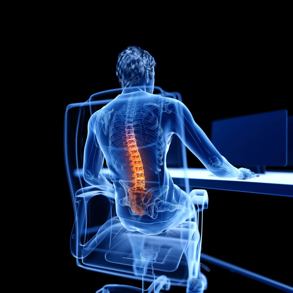 Chiropractic Treatment Techniques for Sciatica — Sydney Spine & Sports Clinic