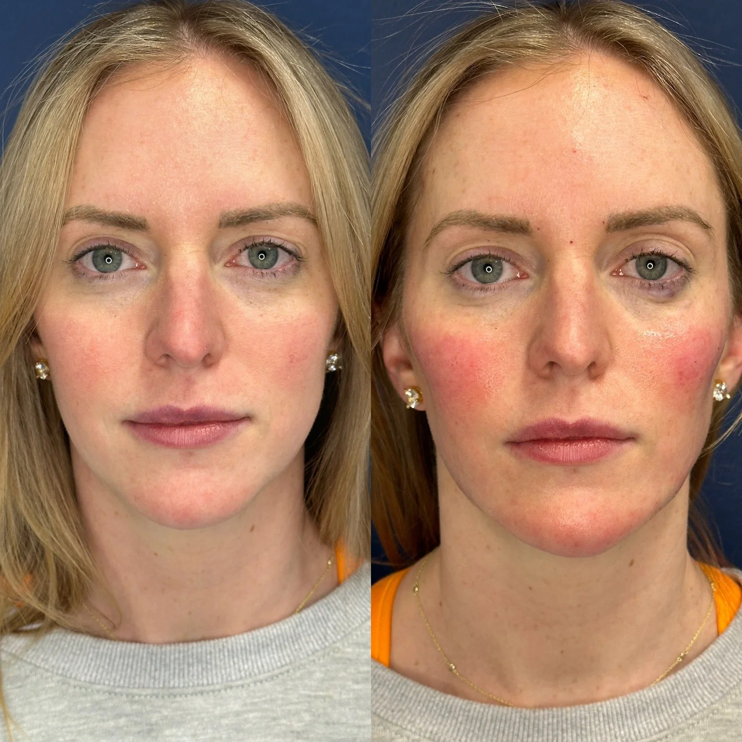 Facial Balancing — IVs by the Seas