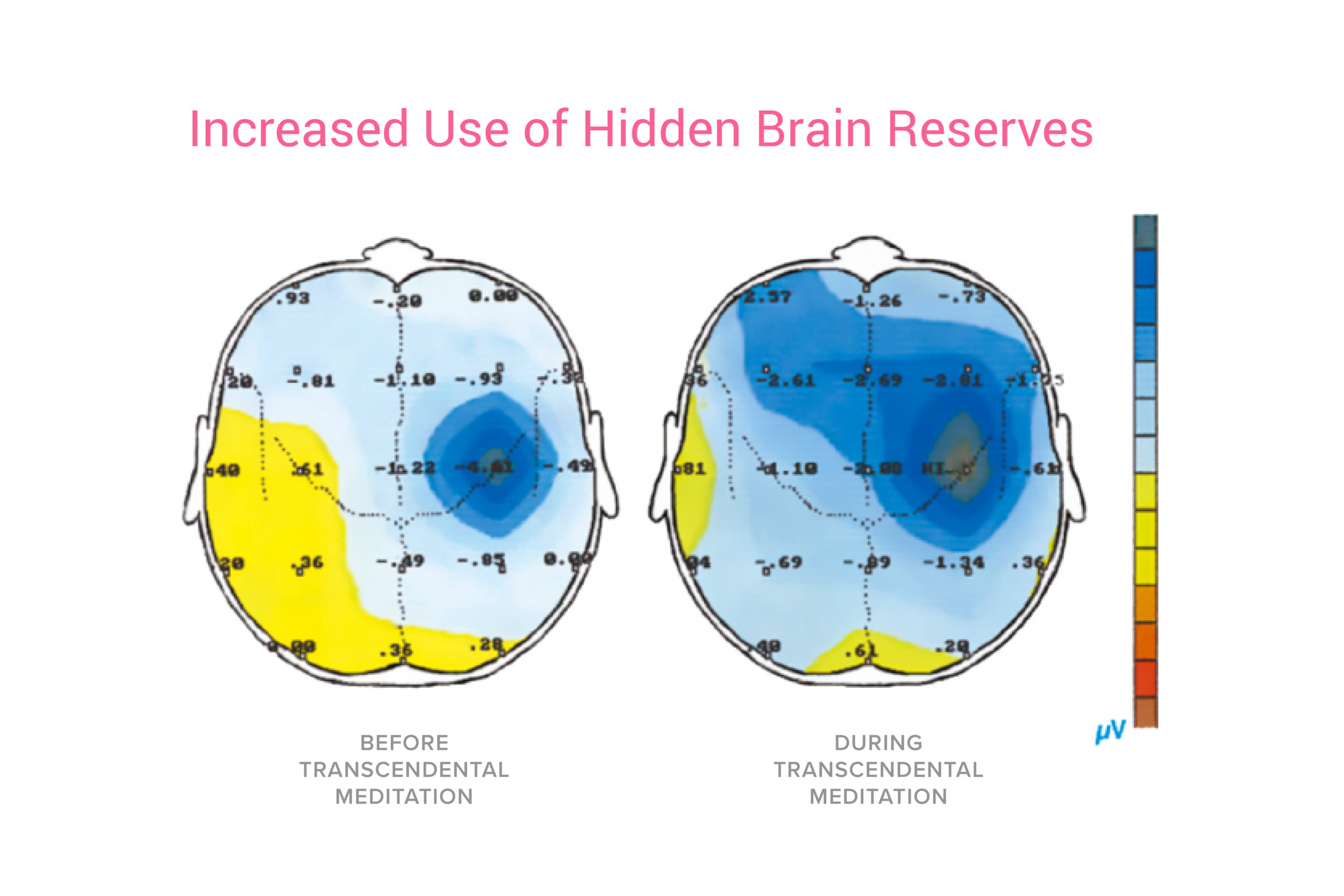 Transcendental Meditation for Women in Australia