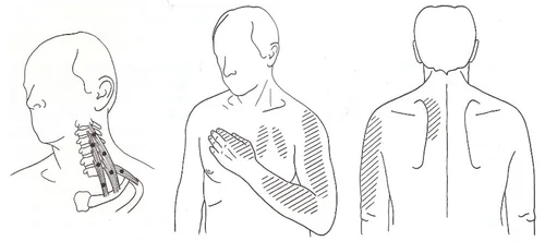 Shoulder Pain — Brooklyn Reflexology