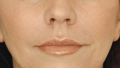Sue Atkinson Aesthetics & Wellness Clinic | Skin & Aesthetic Clinic ...