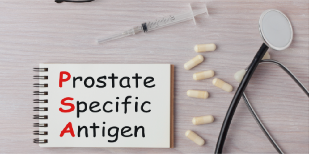 What Is the PSA Test? How It’s Used for Prostate Cancer Detection and ...