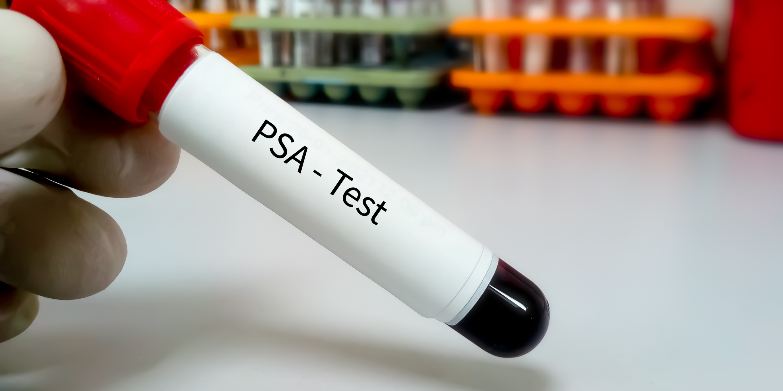 How to Test for an Enlarged Prostate (BPH): A Guide for Men Over 40 ...