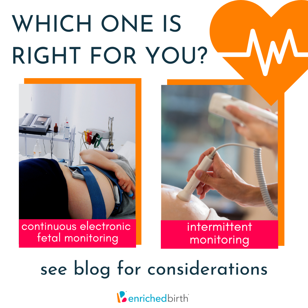 Fetal Monitoring - Which type is right for you? — Enriched Birth