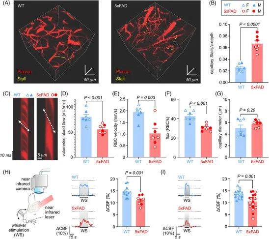 Research — The Harraz Lab