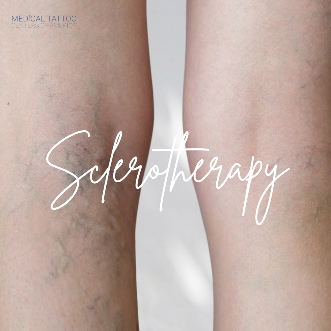 Medical Tattoo Center — Fraîche Studio