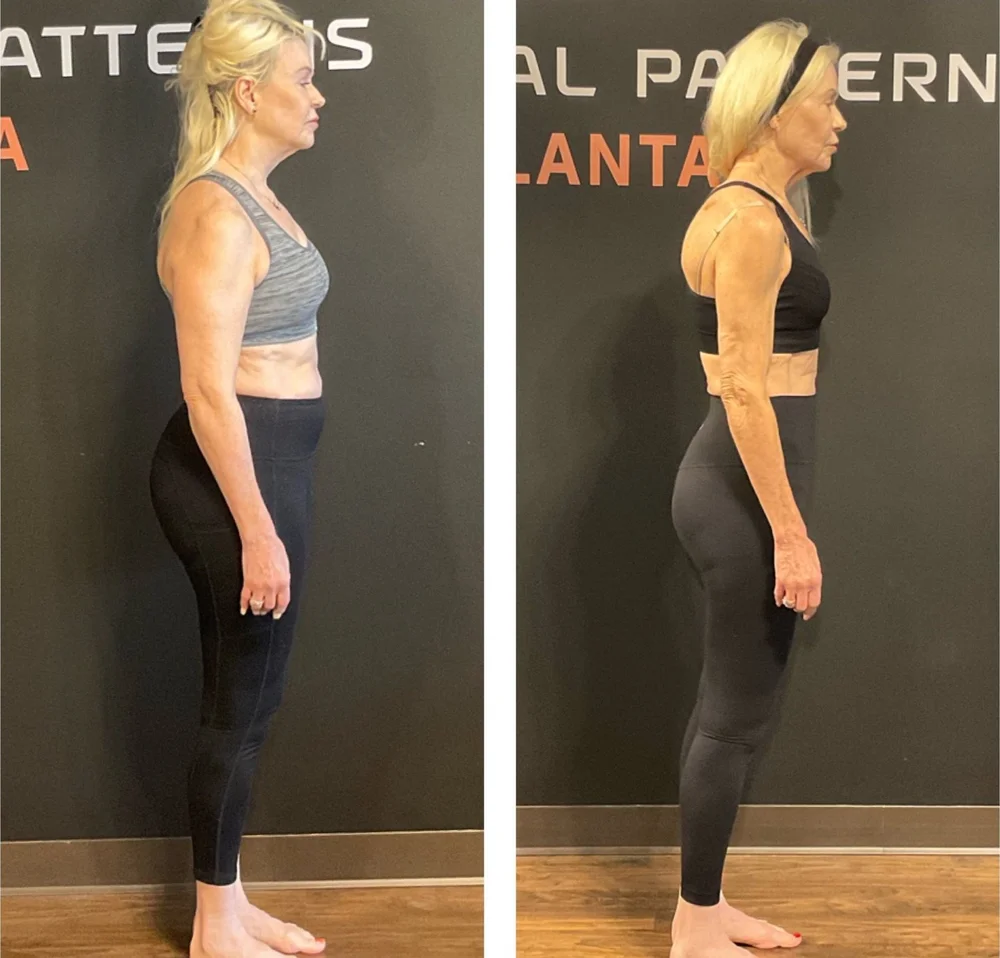 Functional Patterns Atlanta