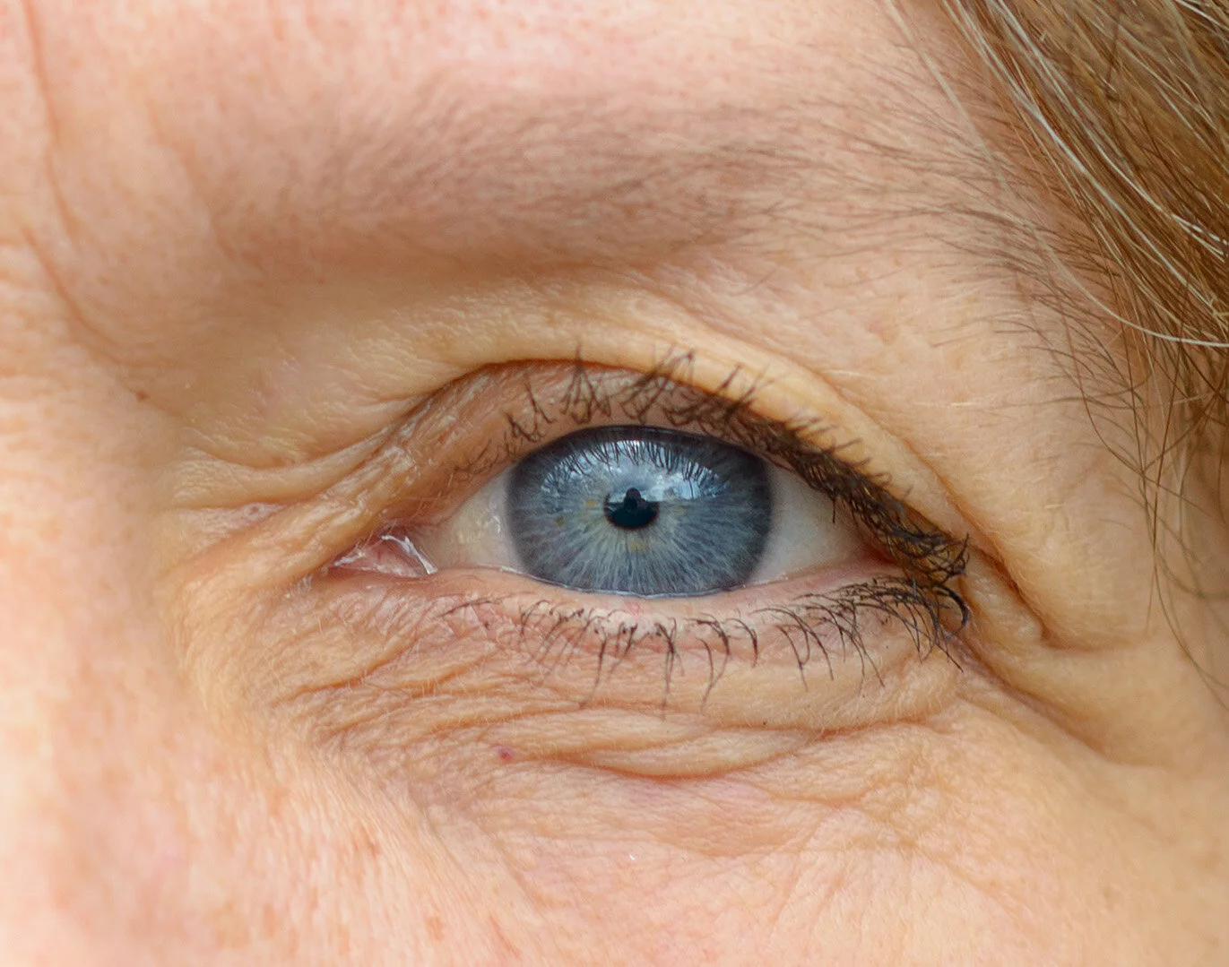 Oculoplastic Surgery — Hobsons Bay Eye Surgeons | Melbourne ...