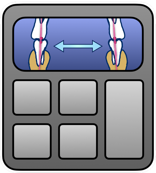 Expansion Calculator — Ortho Calculator