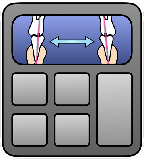 Try the Expansion Calculator! — Ortho Calculator