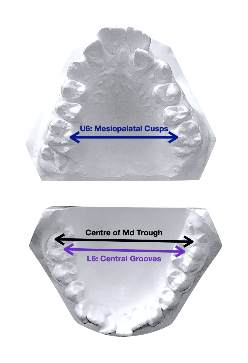Expansion Calculator — Ortho Calculator