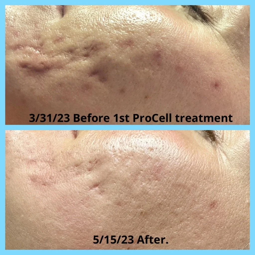 Services — Adiva's Med Spa