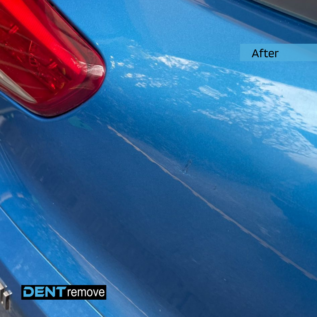 Our Gallery — Dent remove