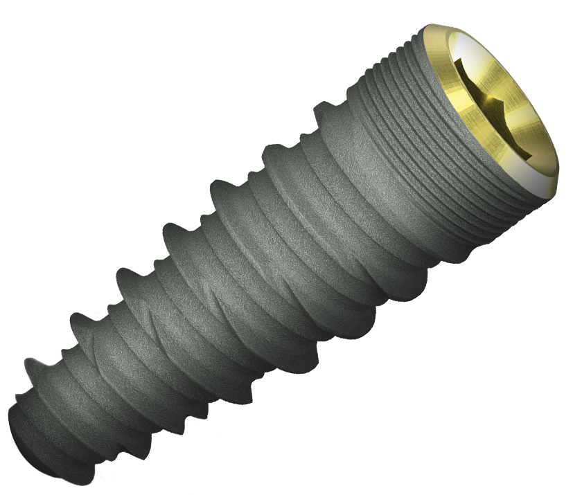 Dental Implants | Frontline Implants