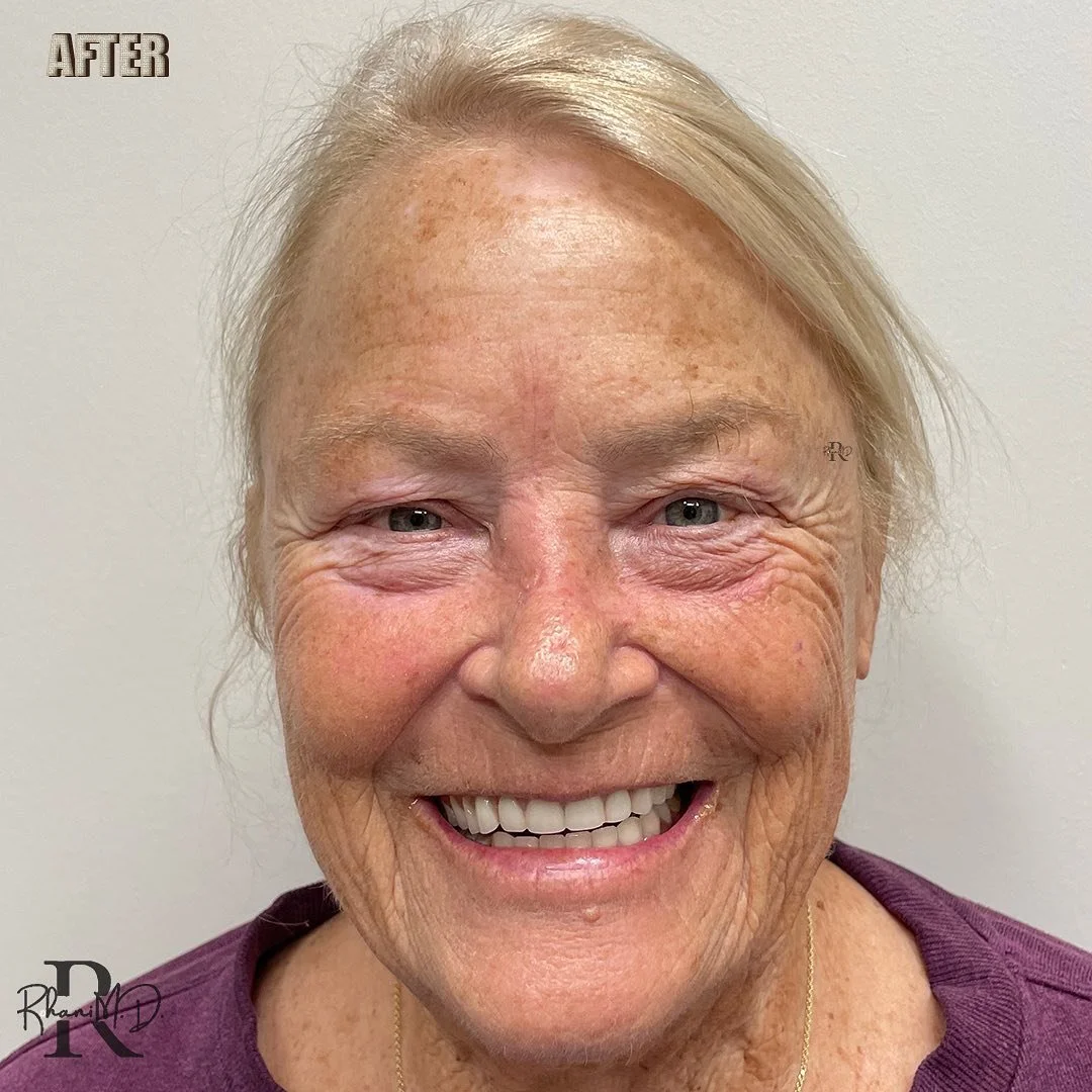 Before & After — ROHANI M.D.