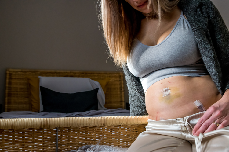 Excision vs. Ablation: Endometriosis Surgery 101 — Lasa Health