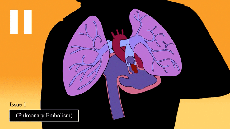 Animation — Black Horse