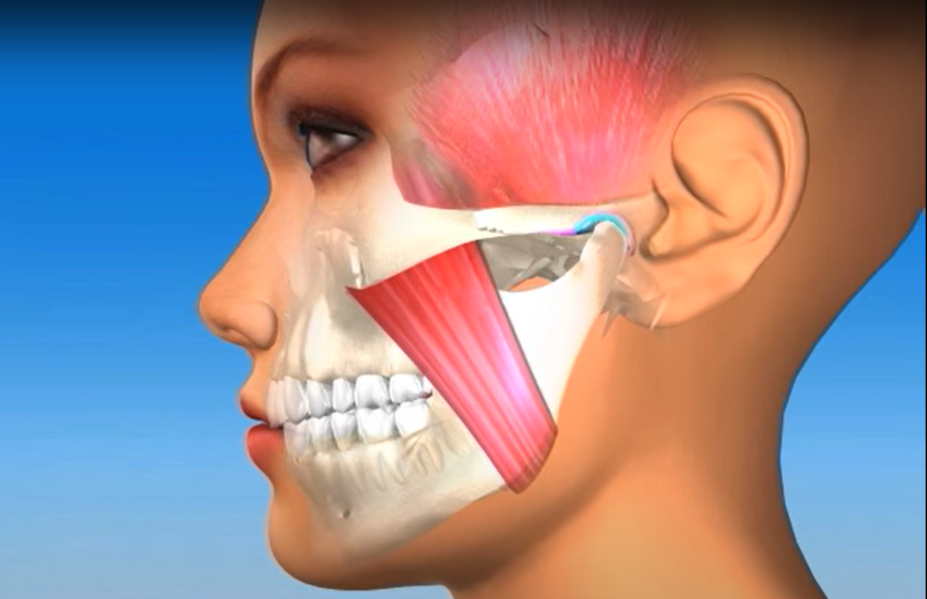 Bio-MAGO TMJ Splint Therapy — Revive Sleep Studio Bio-MAGO TMJ Splint Therapy — Revive Sleep Studio