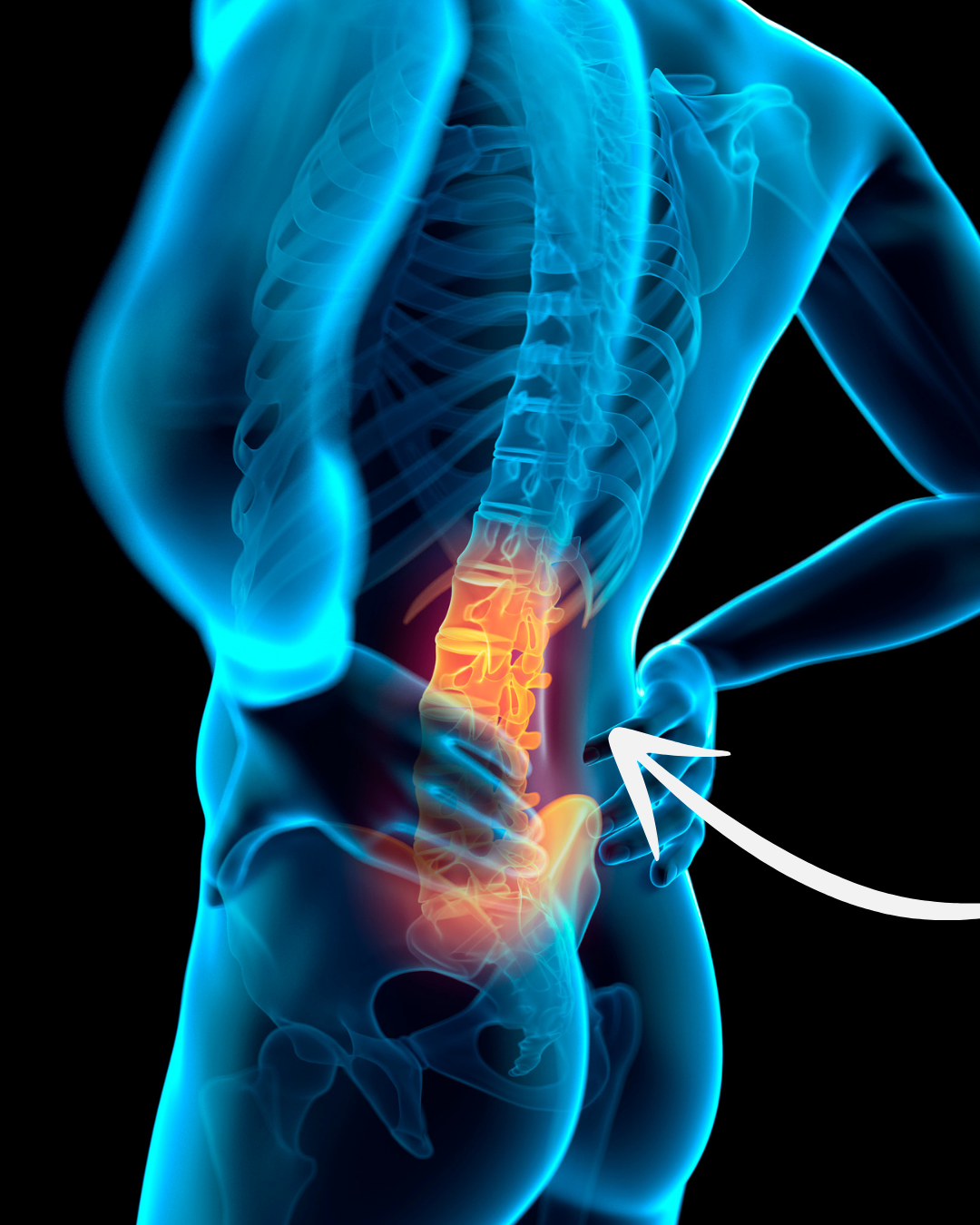 Deadlifts and Lower Back Pain: Common Causes and How To Fix Them — Dr ...