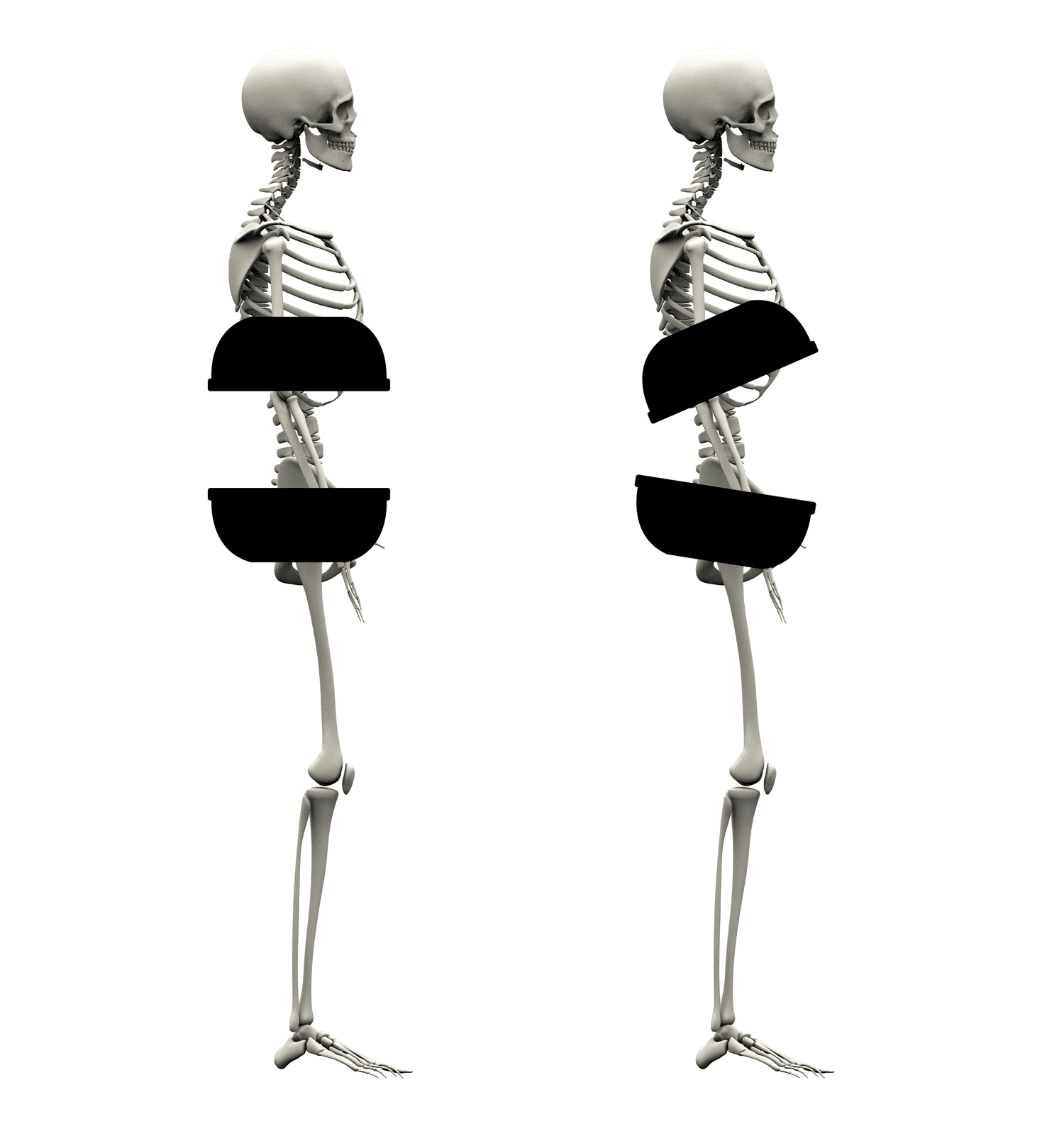 How to Fix Lower Back Pain From Overhead Press — Dr. Beth Ansley ...