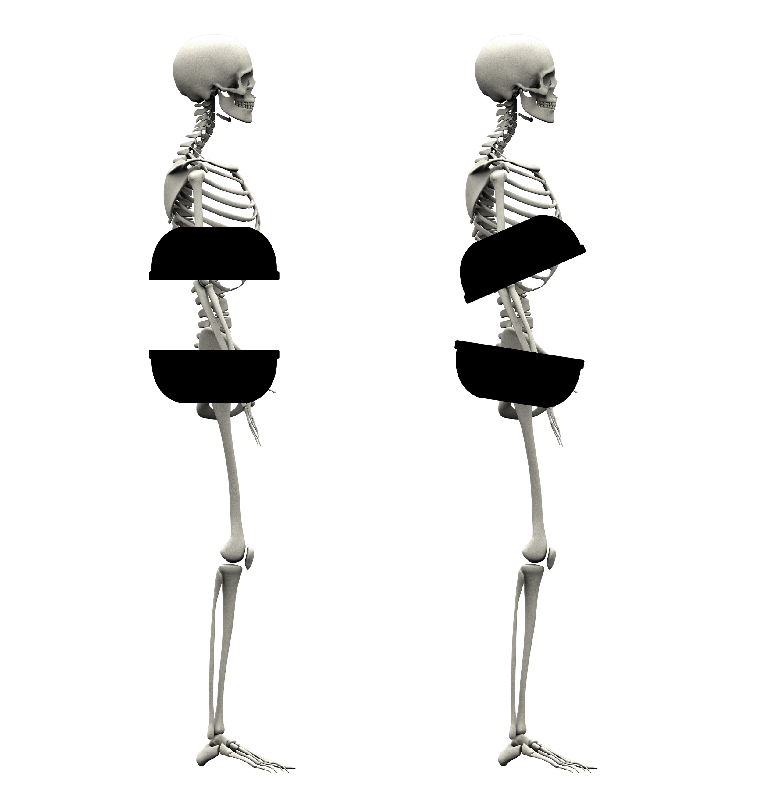 How to Fix Lower Back Pain From Overhead Press — Dr. Beth Ansley ...