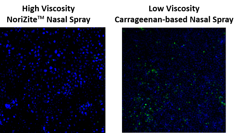 How NoriZite works — Birmingham Biotech