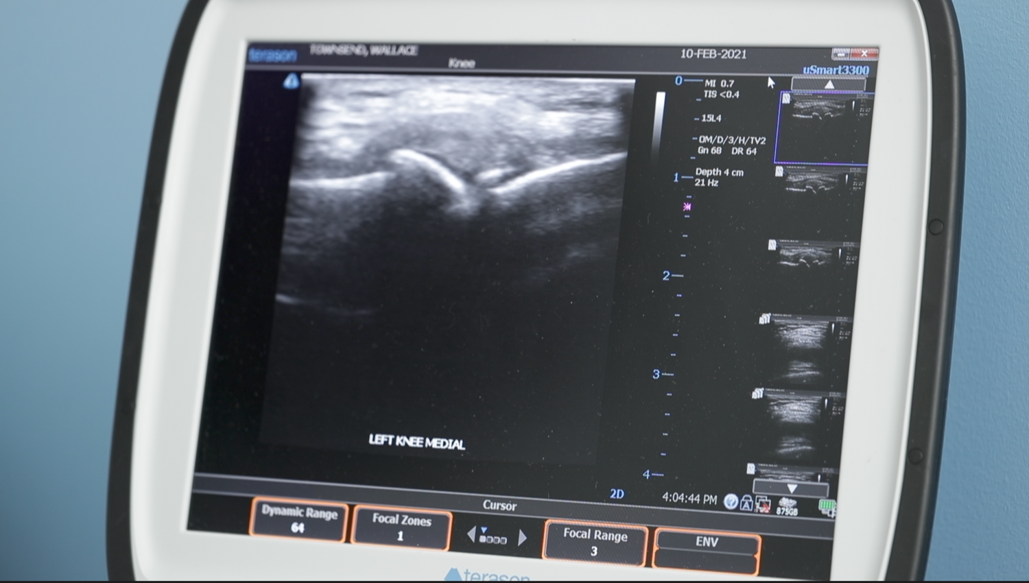 Regenerative Medicine — MSK Guide