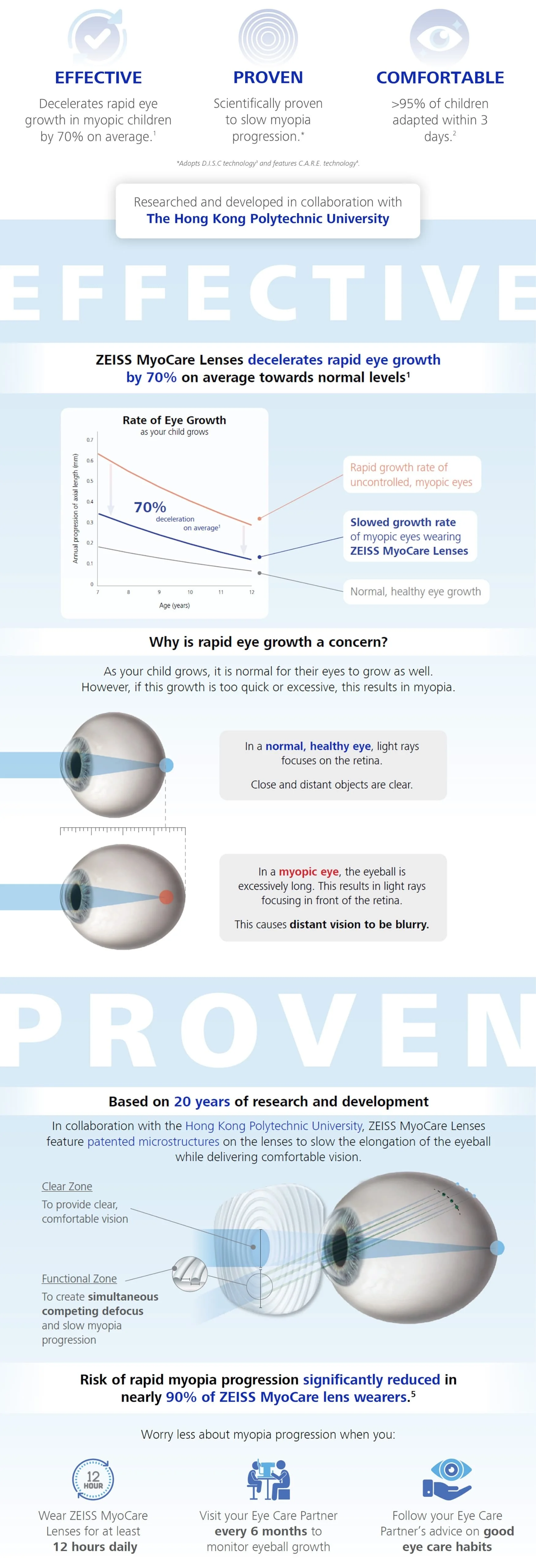 Myopia control glasses — The Eyeclinic by Dr Cheryl Lee